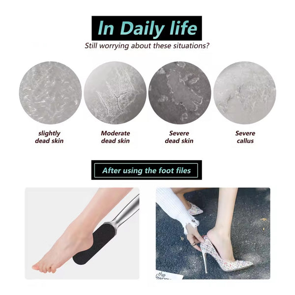 Mira Disposable Sandpaper Foot File Refill No 150 50pcs Pack – Dayjour
